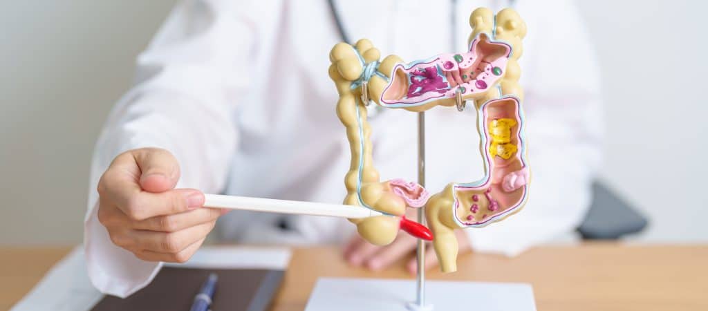 Do You Need a Colon Screening? How a FIT Can Help